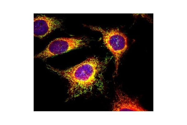 ER Tracer Endoplasmic Reticulum Staining Kits for Live Cells