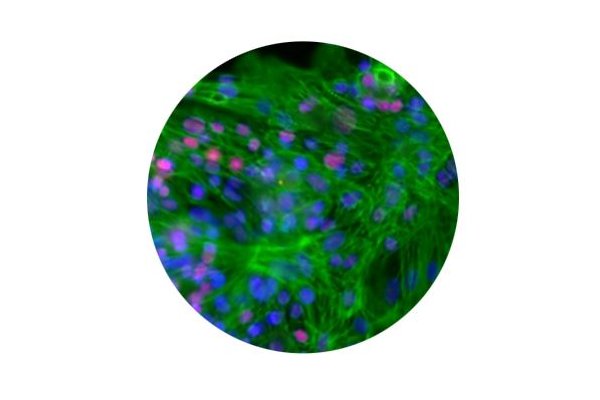 Ncardia - Modeling - Established Cell Models - Human iPSC in ...