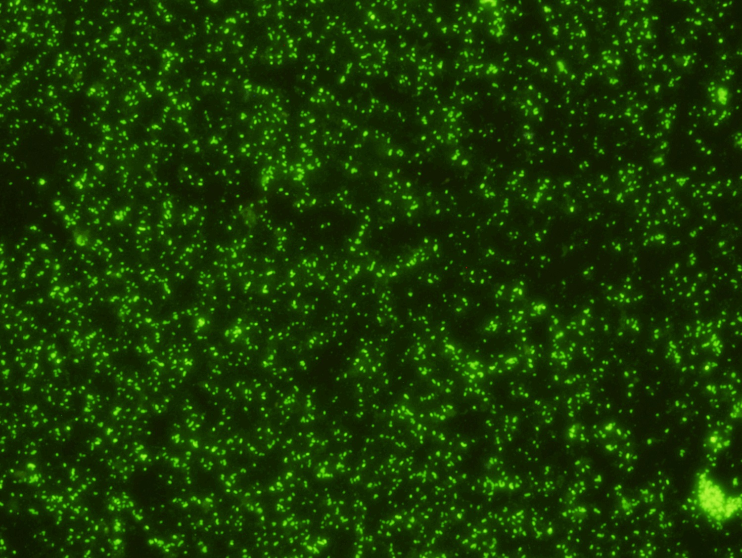 Scimedx Coxiella Burnetii (Q Fever) IFA Slide