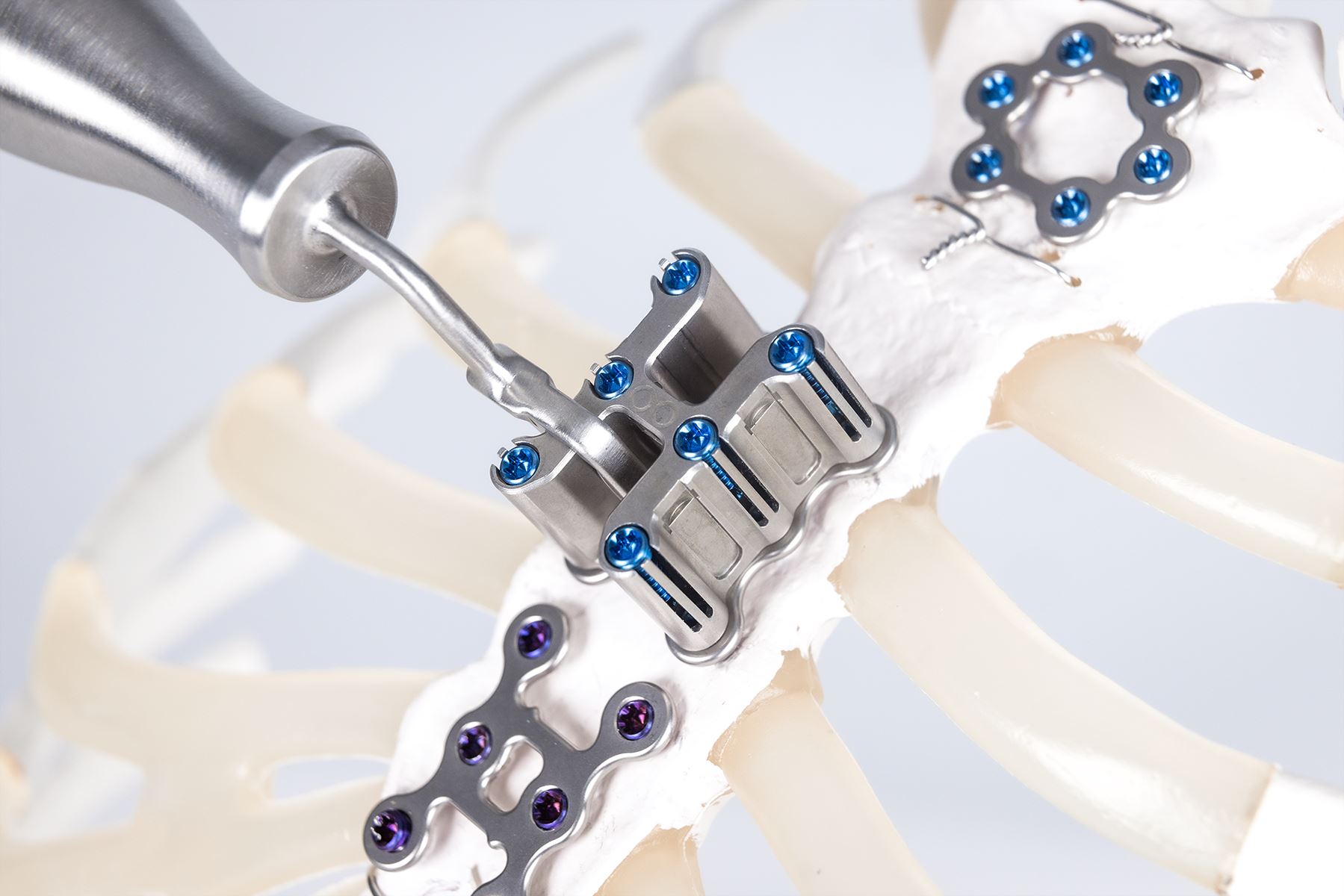 Sternalock Ez Next Generation Closure System 