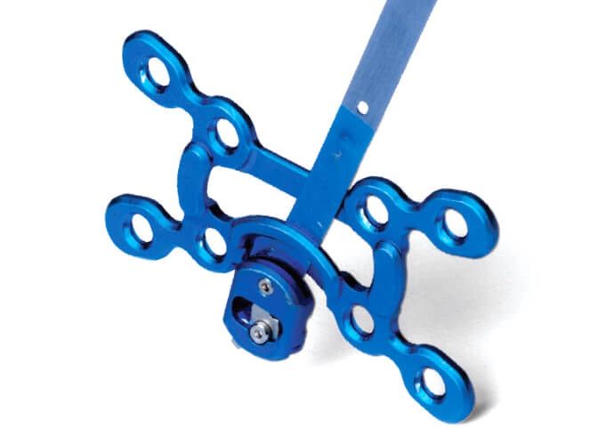 Sternalock - 360 - Sternal Closure - Sternal Rigid Fixation - Sternal ...