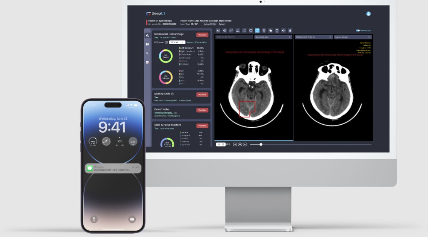 Deep01 Deepct Identifies Intracranial Hemorrhage (ICH) Software