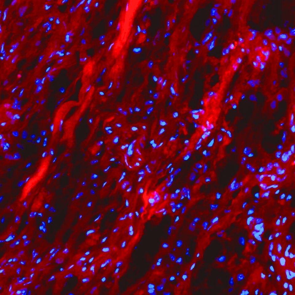 3Helix - R-CHP - Collagen Hybridizing Peptide, Cy3 Conjugate ...