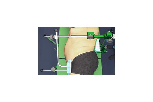 Exact-Fit De Mayo - Surgical Positioning - Hip Positioner