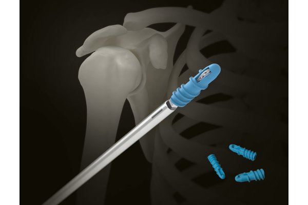 Inion FixOn - Biocomposite Suture Anchor by Inion Oy
