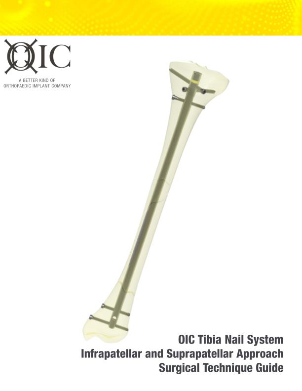 OIC - Tibia Nail System Infrapatellar and Suprapatellar Approach ...