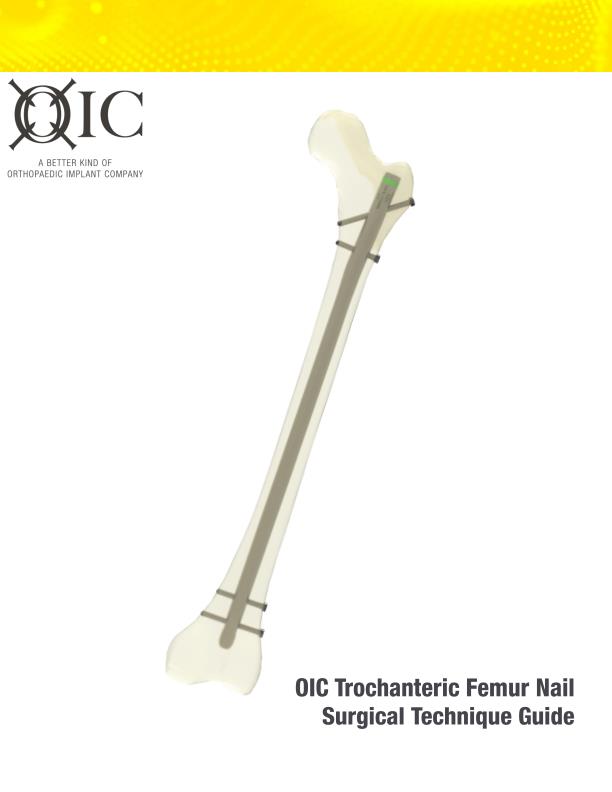 OIC - Trochanteric Femur Nail Surgical - Technique Guide