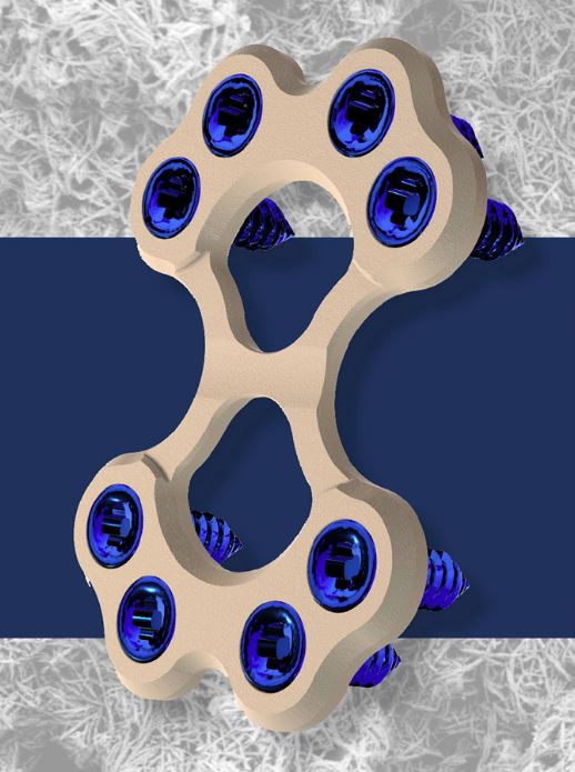 Valkyrie - Thoracic Fixation System by Able Medical Devices Inc.