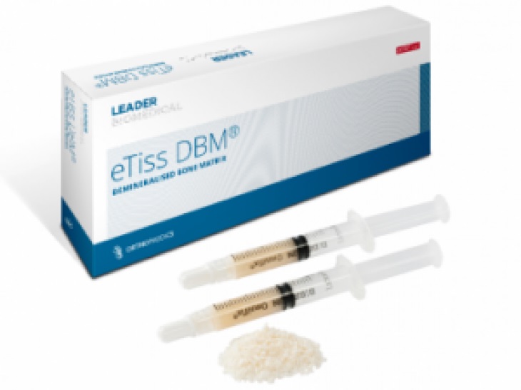 Etiss DBM Demineralised Bone Matrix