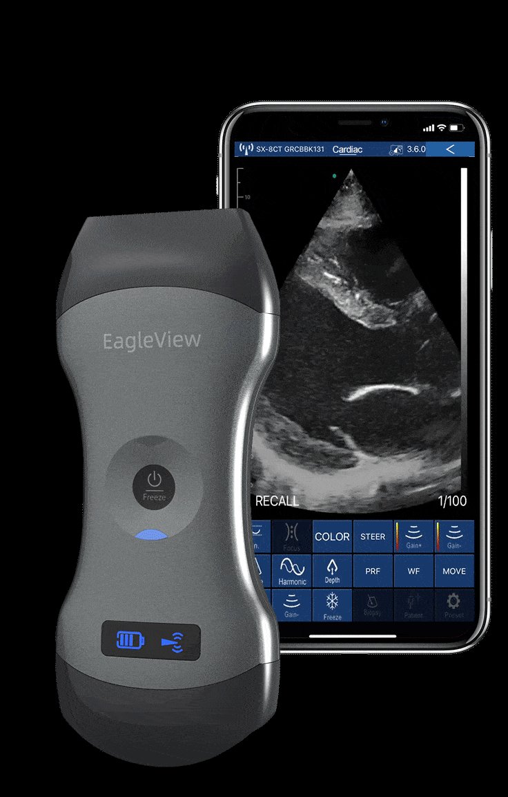 Eagleview Dual-Head Wireless Portable Doppler Ultrasound