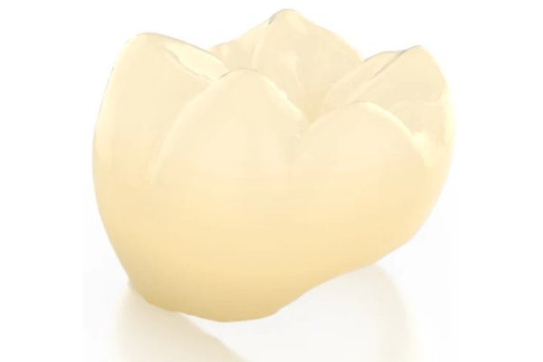 PMMA Alien - Full Solid Crowns - Temporary Crown by Alien ...