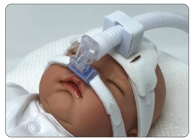 Viomedex Ncpap Generator