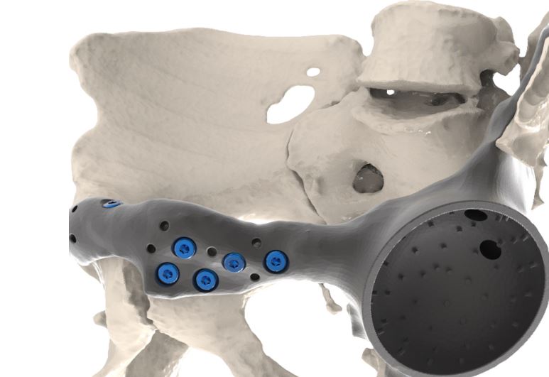 Orthopedics by Techfit Digital Surgery