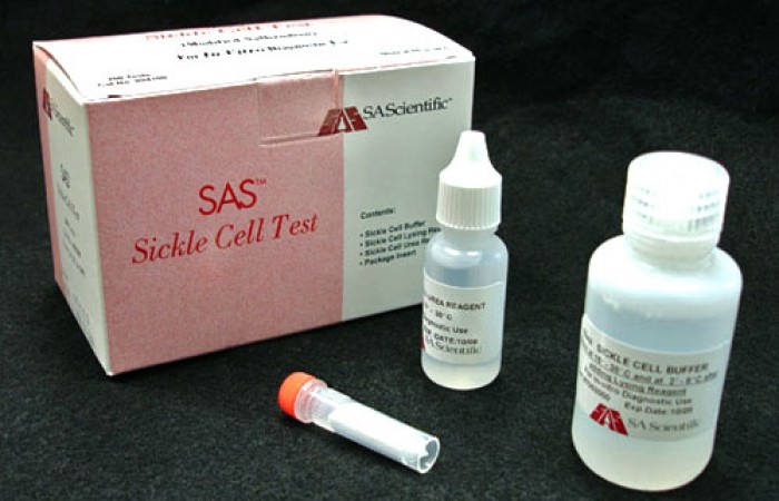 SAS 094100 Sickle Cell Test Kit