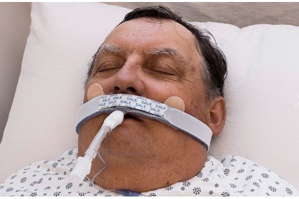 Dale BreezeLock - 280 - Respiratory Care - Endotracheal Tube ...