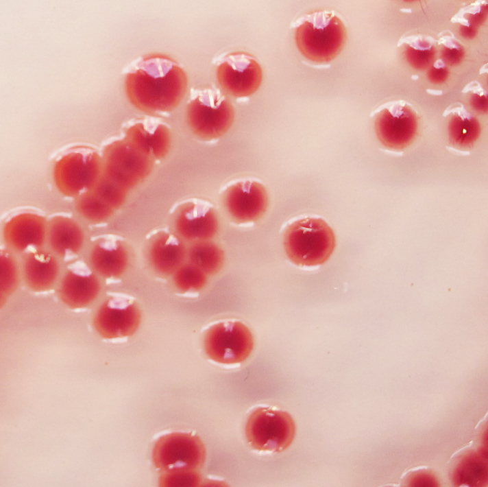 Chromagar - Clinical Microbiology - Acinetobacter by CHROMagar