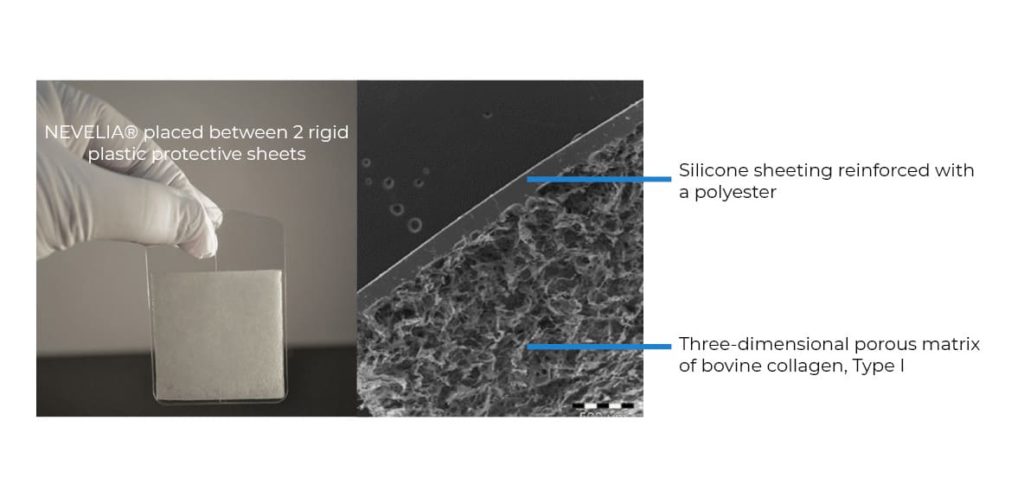 Nevelia - Dermal Regeneration Template by SYMATESE