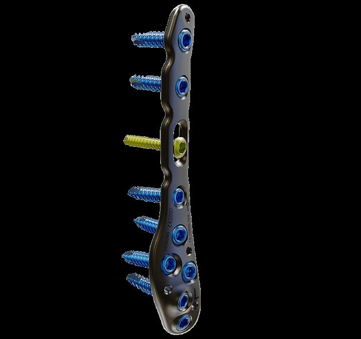 Winsta-Fit Locking Plate System For The Distal Fibula And Tibia