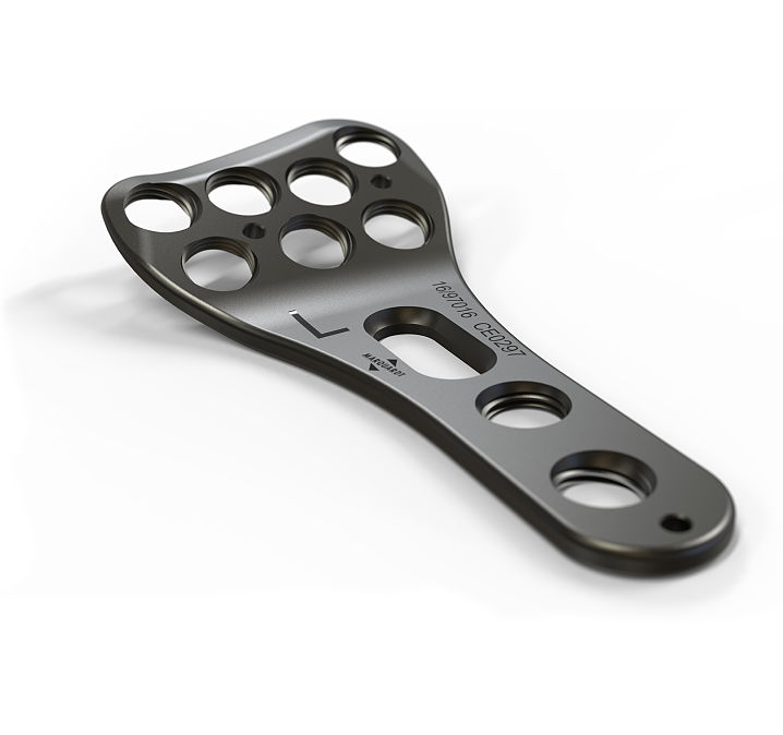Winsta-R Distal Radius System
