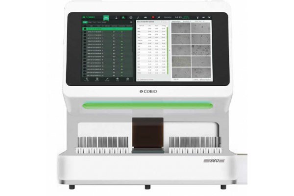 COBIO - S80 - COBIO Products - Automated Urine Sediment ...