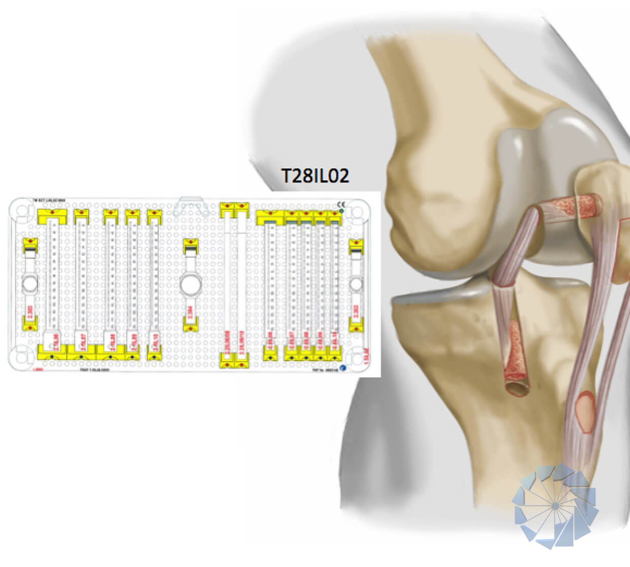 I Instruments SDI® Surgical Diamond Instruments