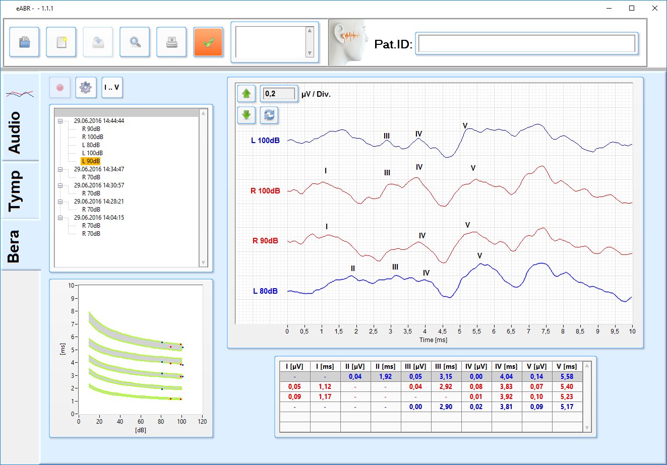eABR USB Auditory Evoked Potentials