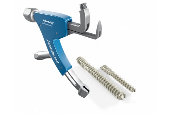 Novastep Pecaplasty - MIS Bunion Correction System By Novastep Inc.