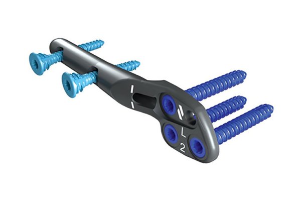 Novastep Centrolock - Guided Transverse Osteotomy System by ...