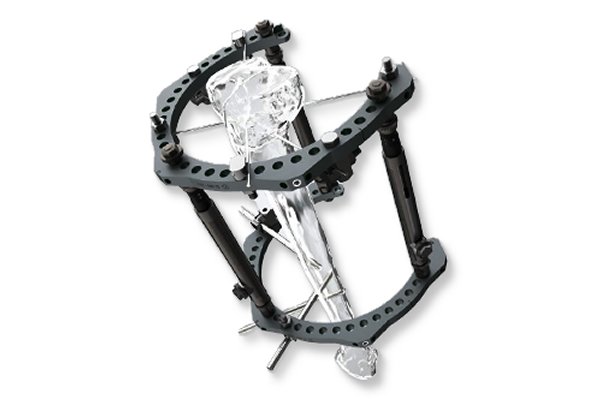 TRAUMA INFIX:EXFIX Orthopedic Implants