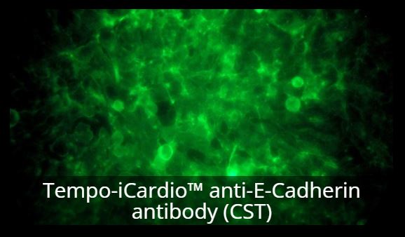 Tempo-iCardio - Induced Pluripotent Stem Cells (IPSC) - Human ...