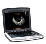 Universal SB NINE Portable Veterinary Ultrasound System