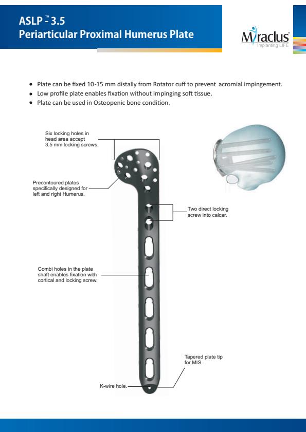 Miraclus - Model ASLP - Proximal Humerus Plate System - Brochure