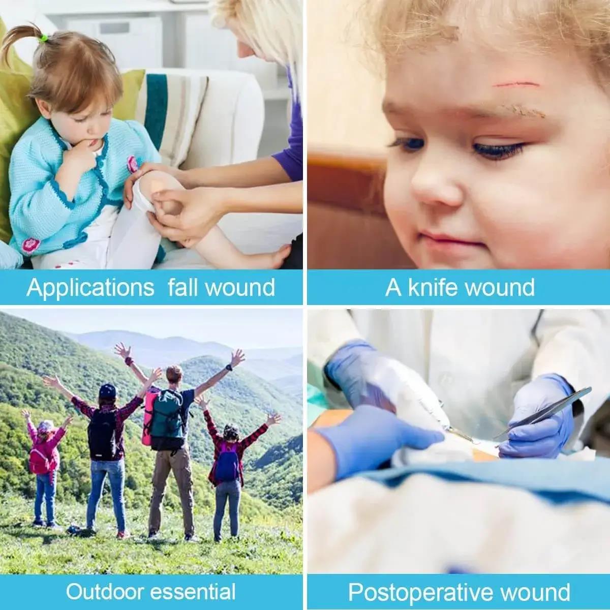 Wound Care Nurse Teaching:Dos And DON'ts For Wounds Healing