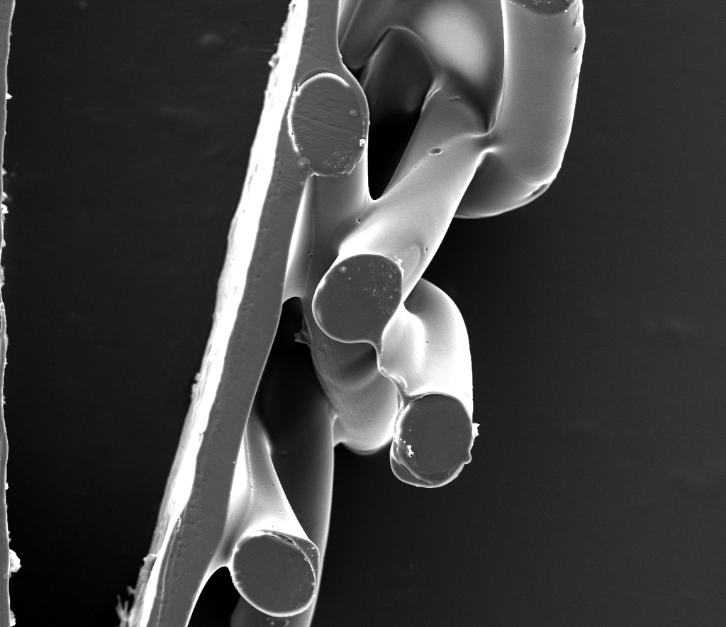 Proheal EHD Composite Dual Layer Hernia Repair Mesh PLCL Absorbable ...