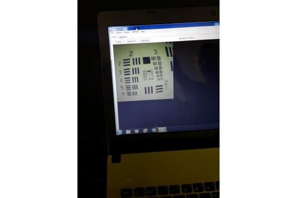 Micron - Medical Endoscopes - Micro Video Endoscope By ...